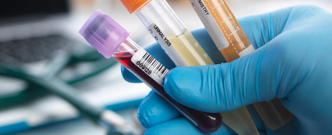 Air Force DDRP Guidance | TricareRehabs.com | Get Support