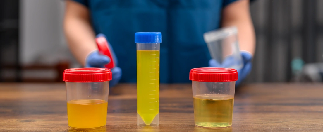 Air Force DDRP Guidance | TricareRehabs.com | Get Support